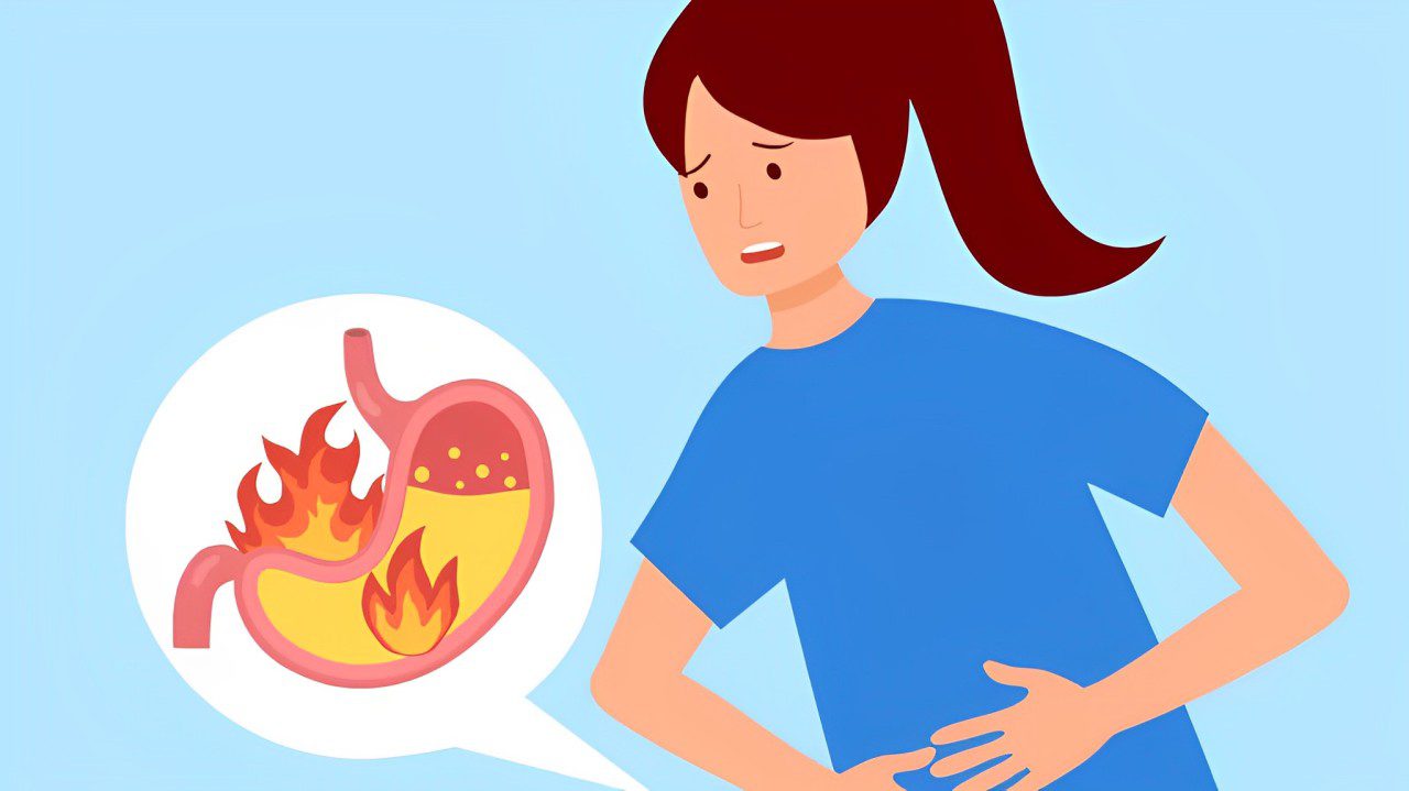 Heartburn 101 | Roots Health DPC